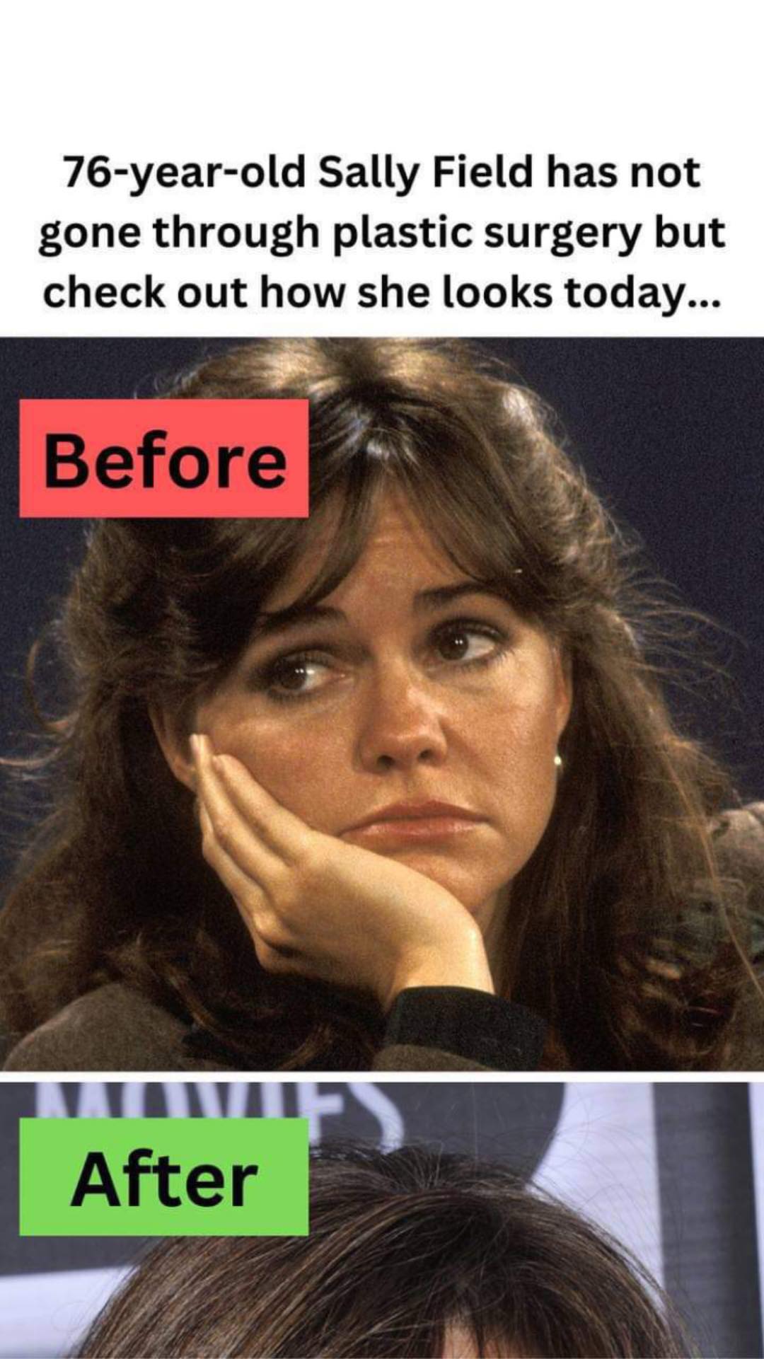 76-year-old Sally Field has not gone through plastic surgery but check ...